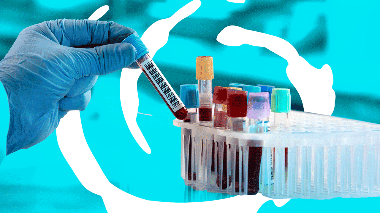 AFT Pharmaceuticals (ASX:AFP) debuts pain relief medication Maxigesic ...